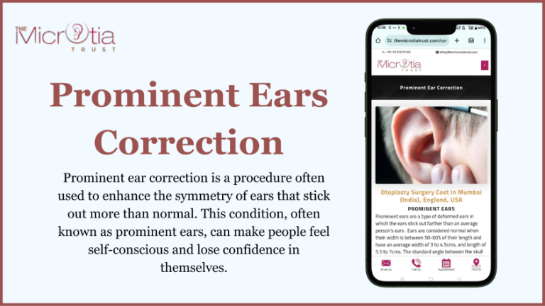 Understanding the Surgery for Prominent Ears